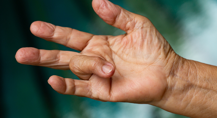 Trigger Finger Treatment Without Surgery Louisville Ky Norton Healthcare Trigger Finger Treatment Without Surgery Louisville Ky Norton Healthcare